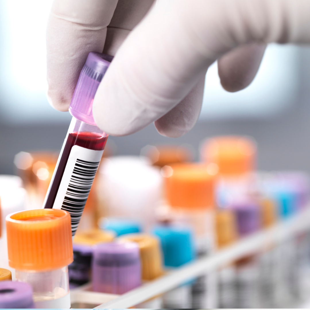 London Health Company Blood Testing Kits