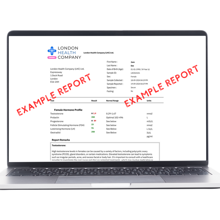 Electrolyte / Minerals Blood Test Kit (Magnesium & Calcium)